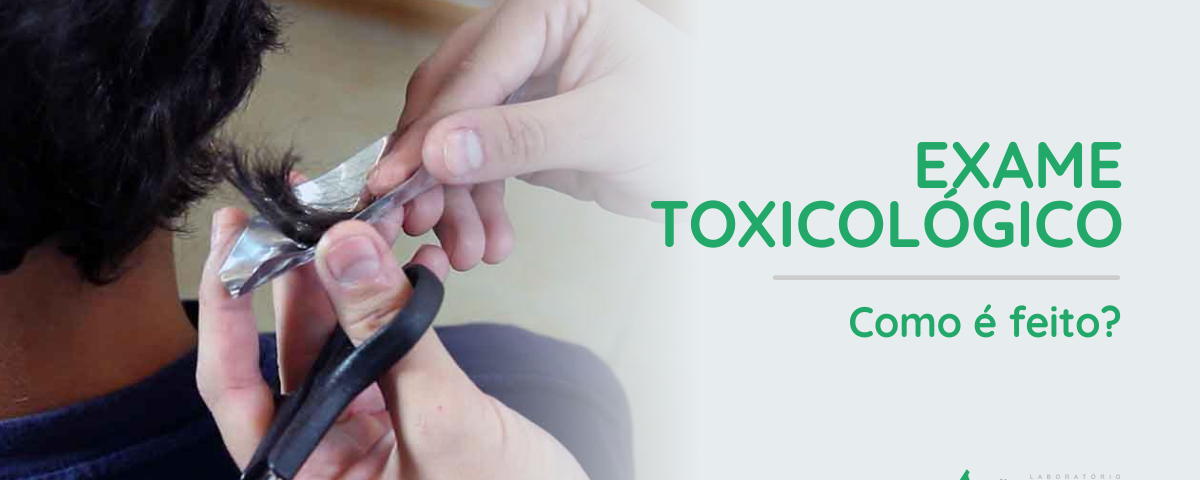 O que é o exame toxicológico e como é feito – Laboratório São Geraldo